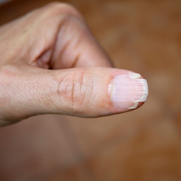 Basic Manicure - GlossaryLive