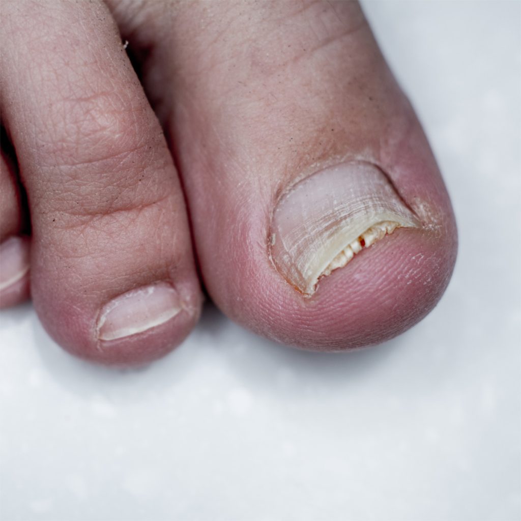 Foundation of Nail Structure - GlossaryLive