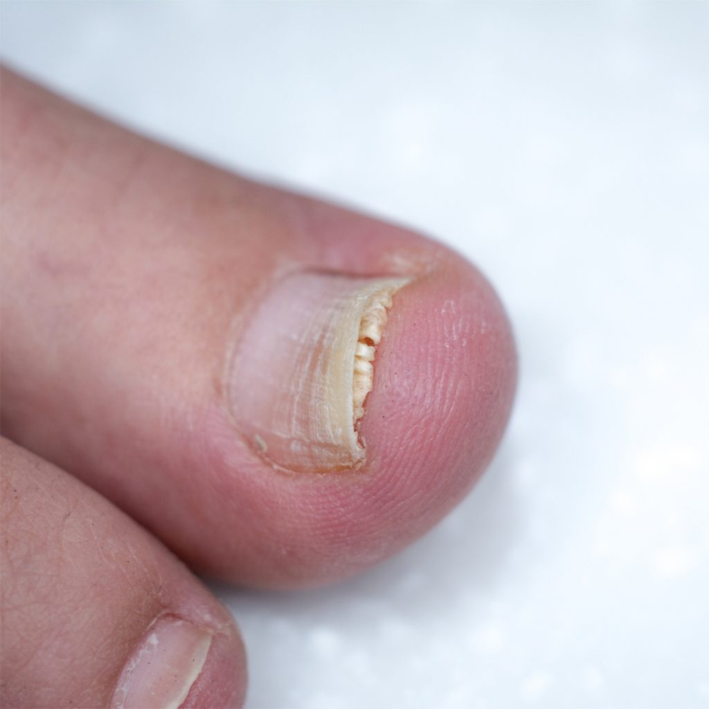 Foundation of Nail Structure - GlossaryLive