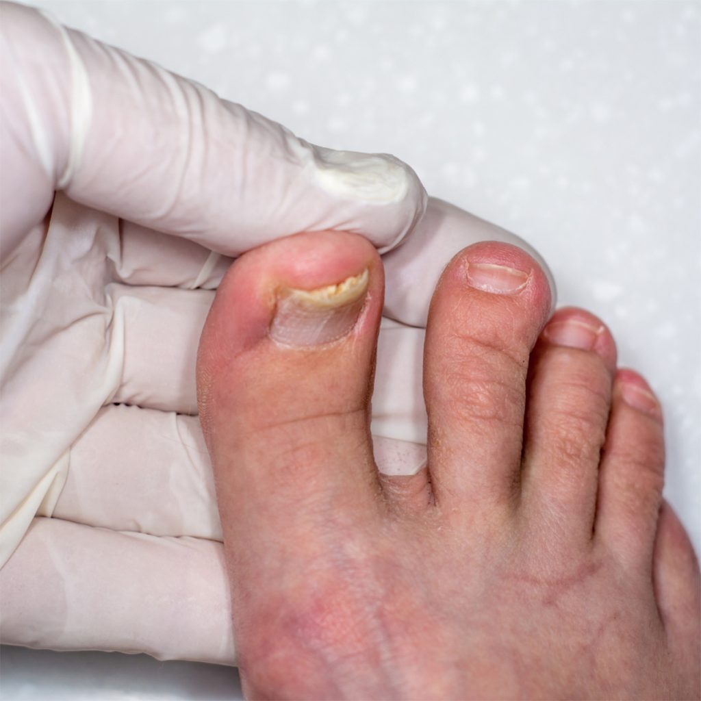 Foundation of Nail Structure - GlossaryLive